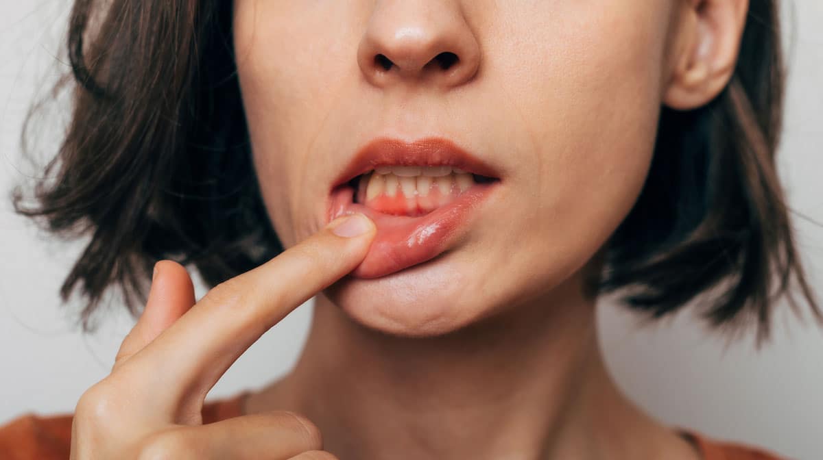 Why you need to treat gum diseases early | Fulham Road Dental