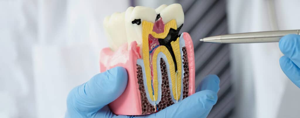 Get rid of toothache for good with the help of your dentist!